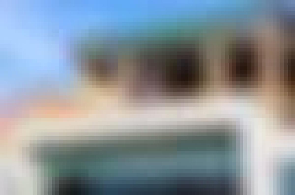 ГССҮТ ийн эмч нар үений гадаргуу мөгөөрсийг шилжүүлэн суулгах мэс заслын шинэ технологи нэвтрүүллээ